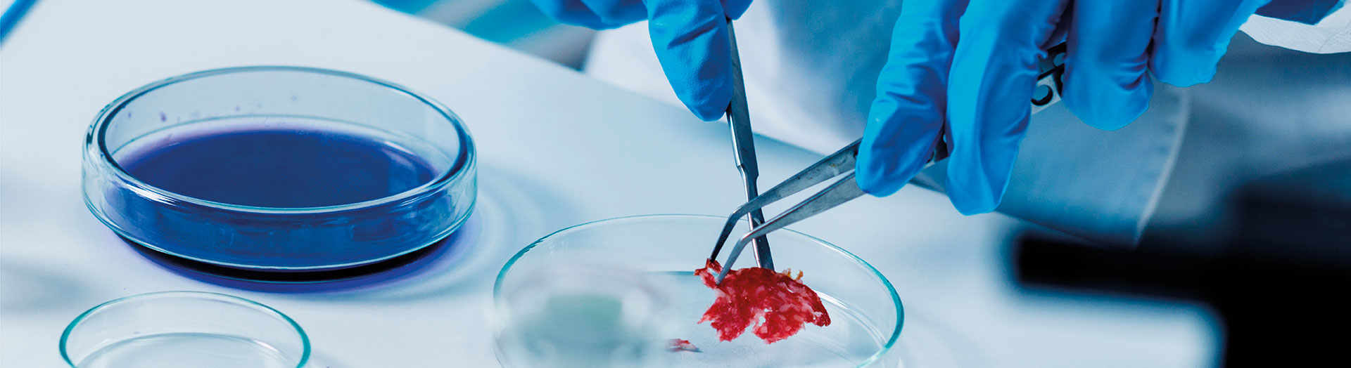 ΑΣΦΑΛΕΙΑ ΤΡΟΦΙΜΩΝ - Allanton